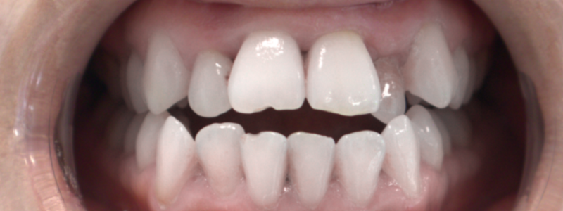 Harley Street Smiles